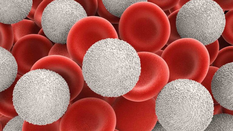 5 Most Common Reasons For Low White Blood Cell Count (Leukopenia)